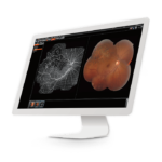 DRI OCT Triton series - Topcon Healthcare - APAC